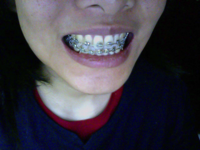 Avoiding Vision Dafilms Watch Online